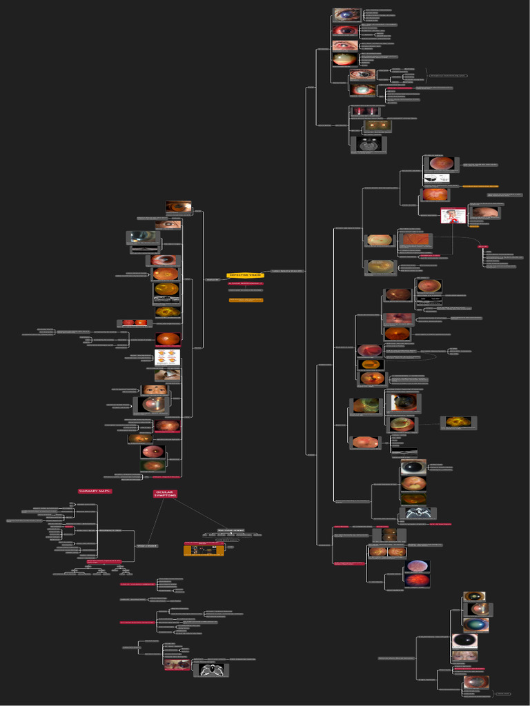 Defective Vision - Illustrated Mind Map by DR Pranesh | PDF | Ischemia | Medical Specialties
