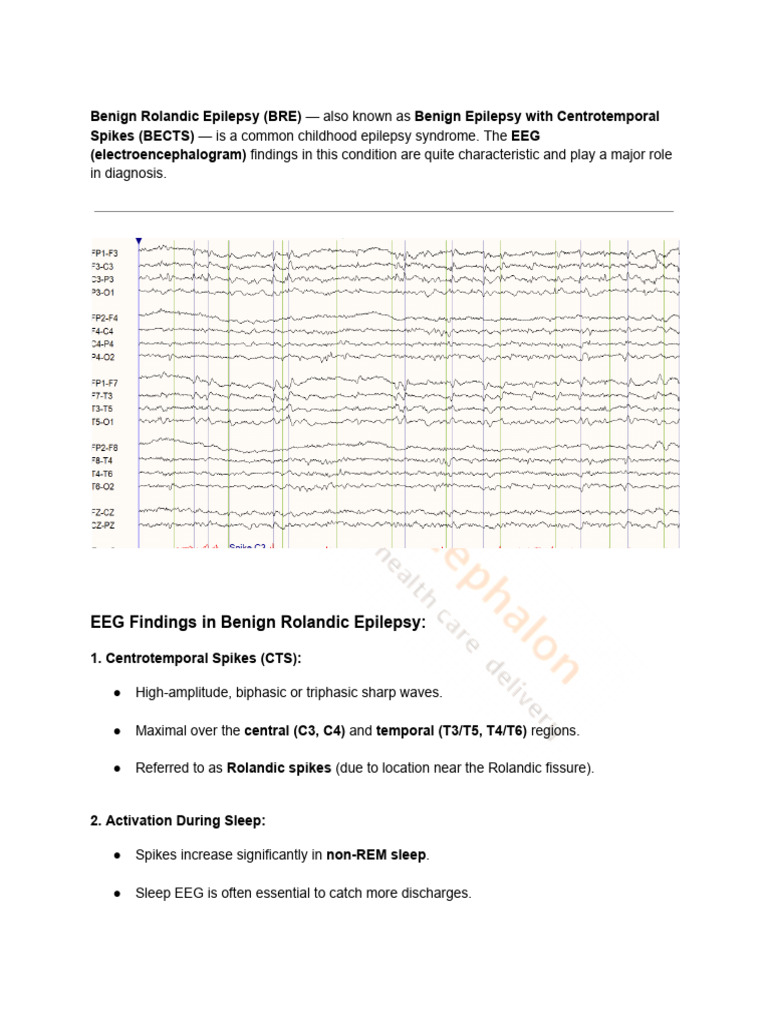 EEG Characteristics of Benign Rolandic Epilepsy | PDF