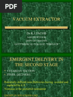 Vacuum Delivery: Procedure and Complications | PDF