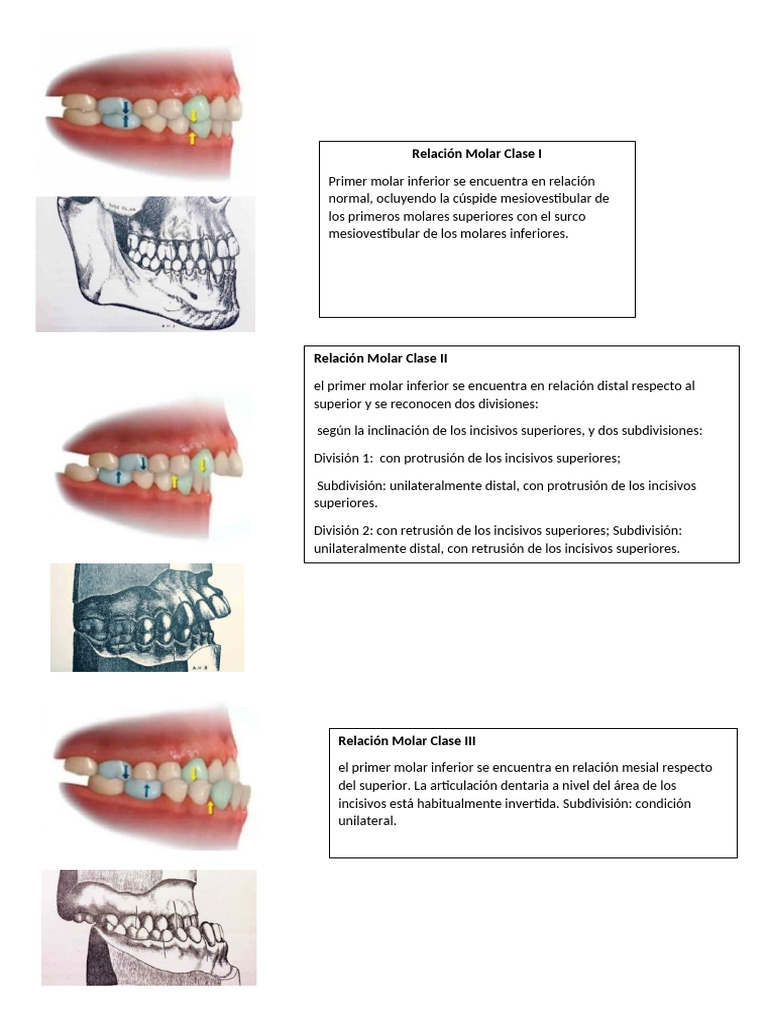 Relacion Molar y Canina | PDF