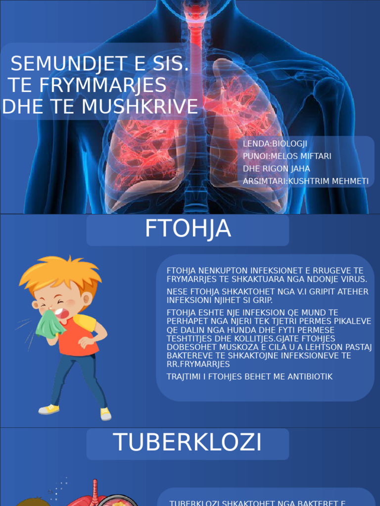 Semundjet e Sis | PDF