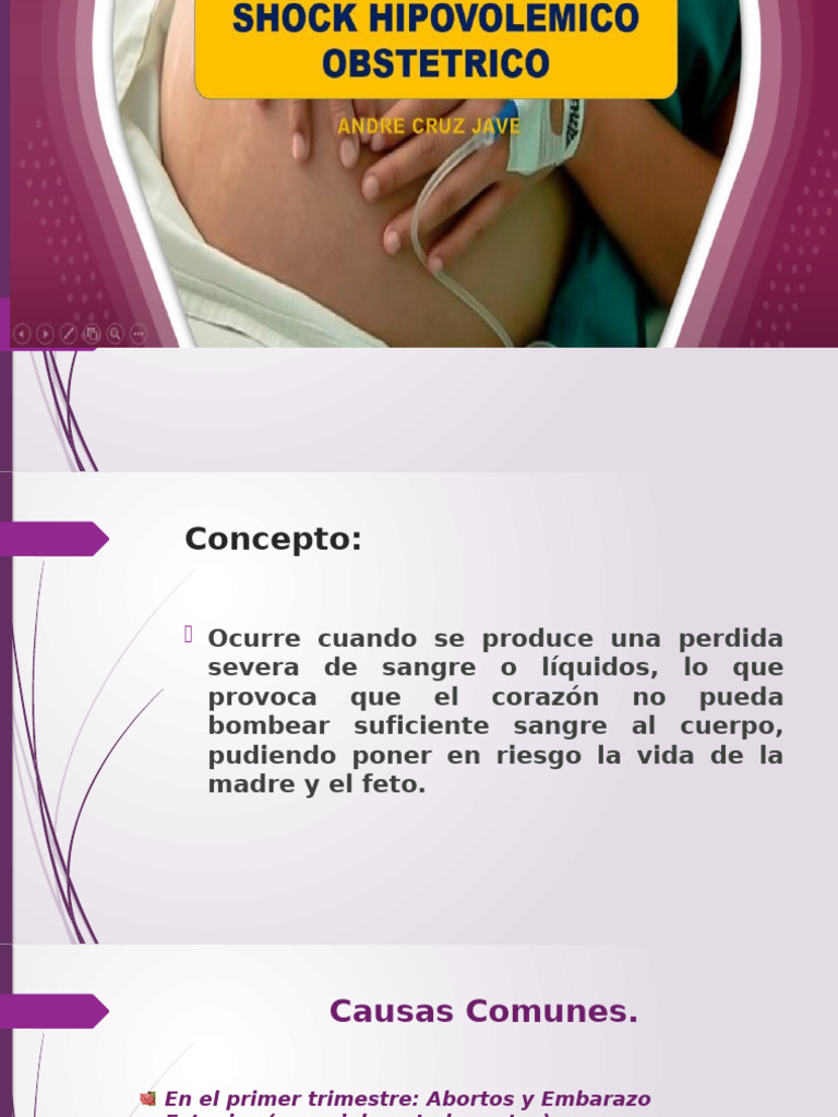 CHock Hipovolemico | PDF