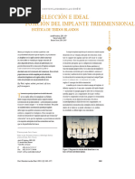 Guía fácil Neodent Helix GM Narrow | PDF | Implante dental | Cirugía