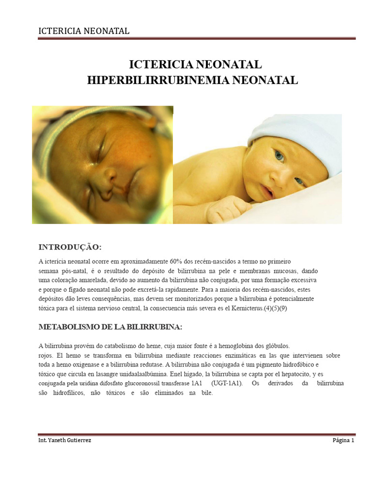 Icterícia Neonatal | PDF | Bile | Especialidades médicas