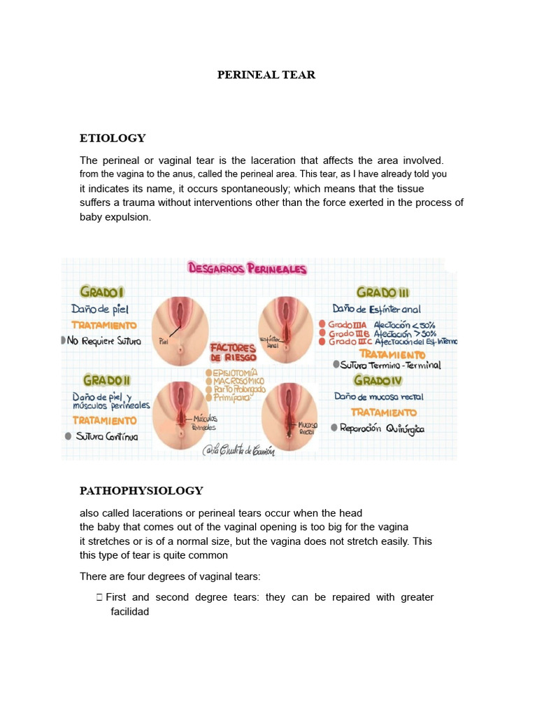 Understanding Perineal Tears and Risks | PDF | Uterus | Human Pregnancy