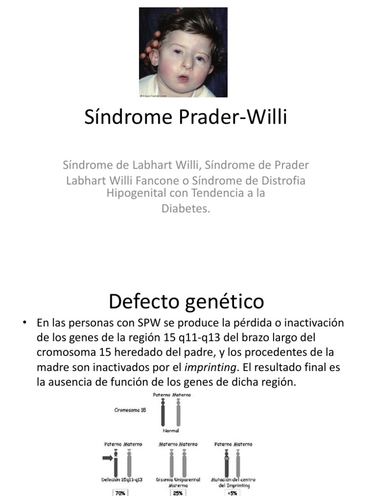 Características del Síndrome de Prader-Willi | PDF | Especialidades ...