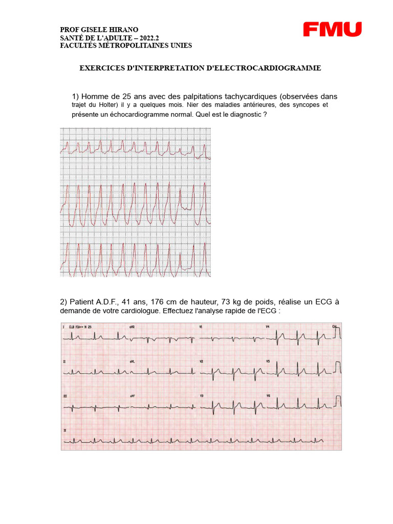 Interprétation ECG : Diagnostics Clés | PDF | Électrocardiographie ...
