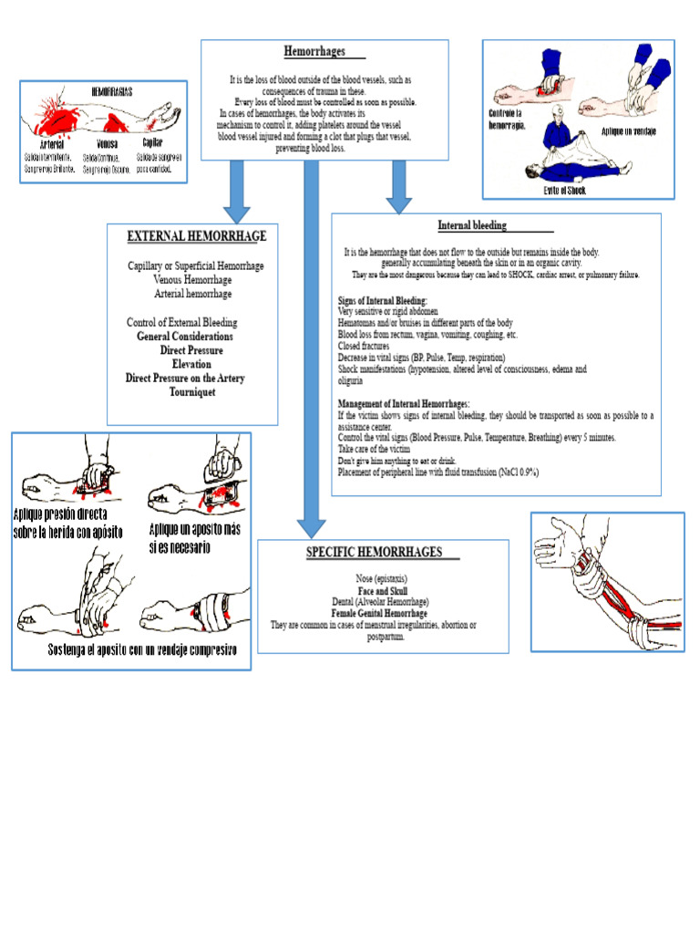 Understanding Hemorrhages and Management | PDF | Bleeding | Shock ...