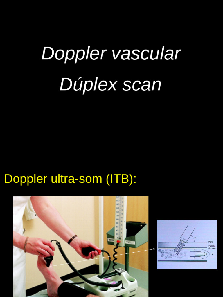 Doppler vascular e Duplex scan, cirurgia vascular | PDF | Isquemia ...