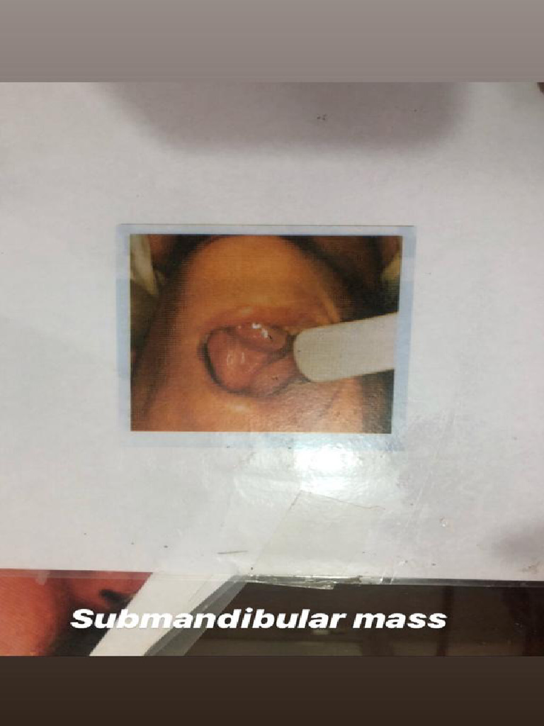 ENT (Instruments -Videos) | PDF