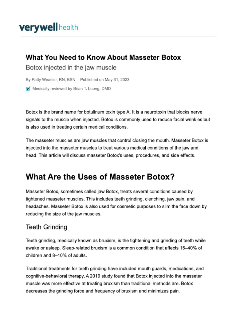 Masseter Botox | PDF