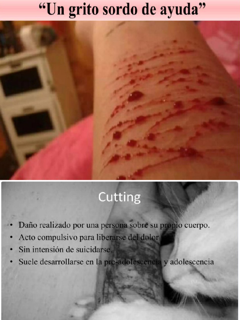 Cuting | PDF