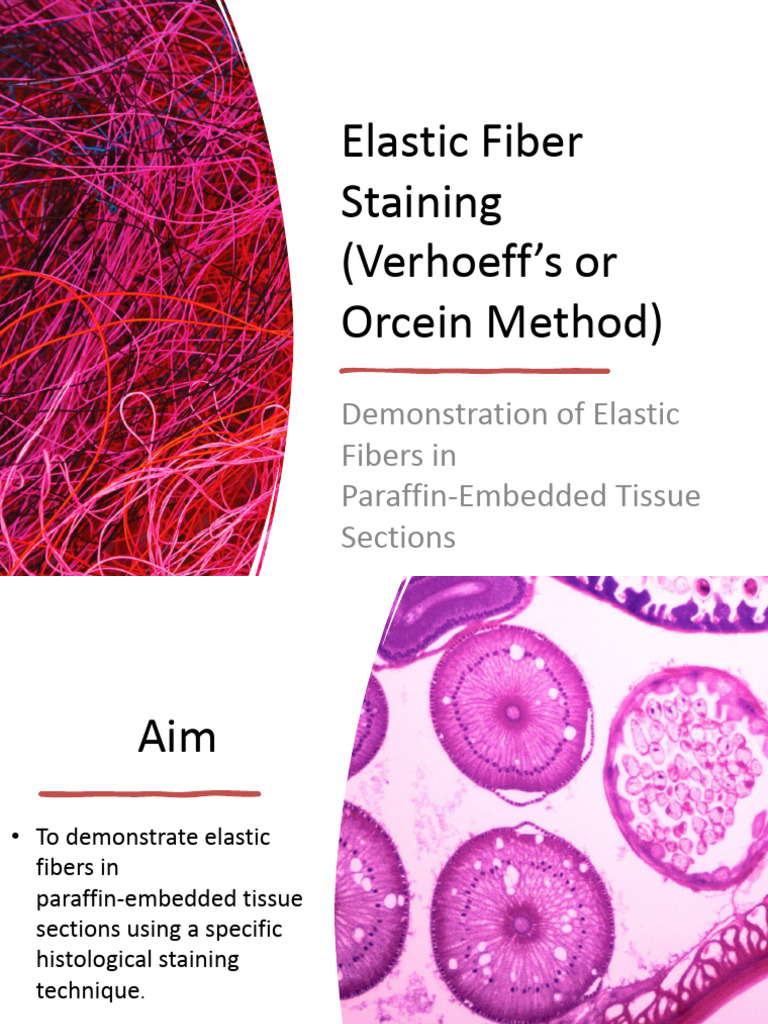 Elastic Fiber Staining Techniques Guide | PDF | Staining | Histology