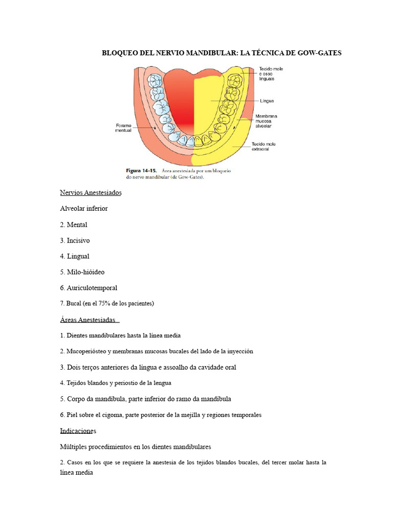 Bloqueo Del Nervio Mandibular Gow Gates | PDF | Inyección (medicina) | Boca