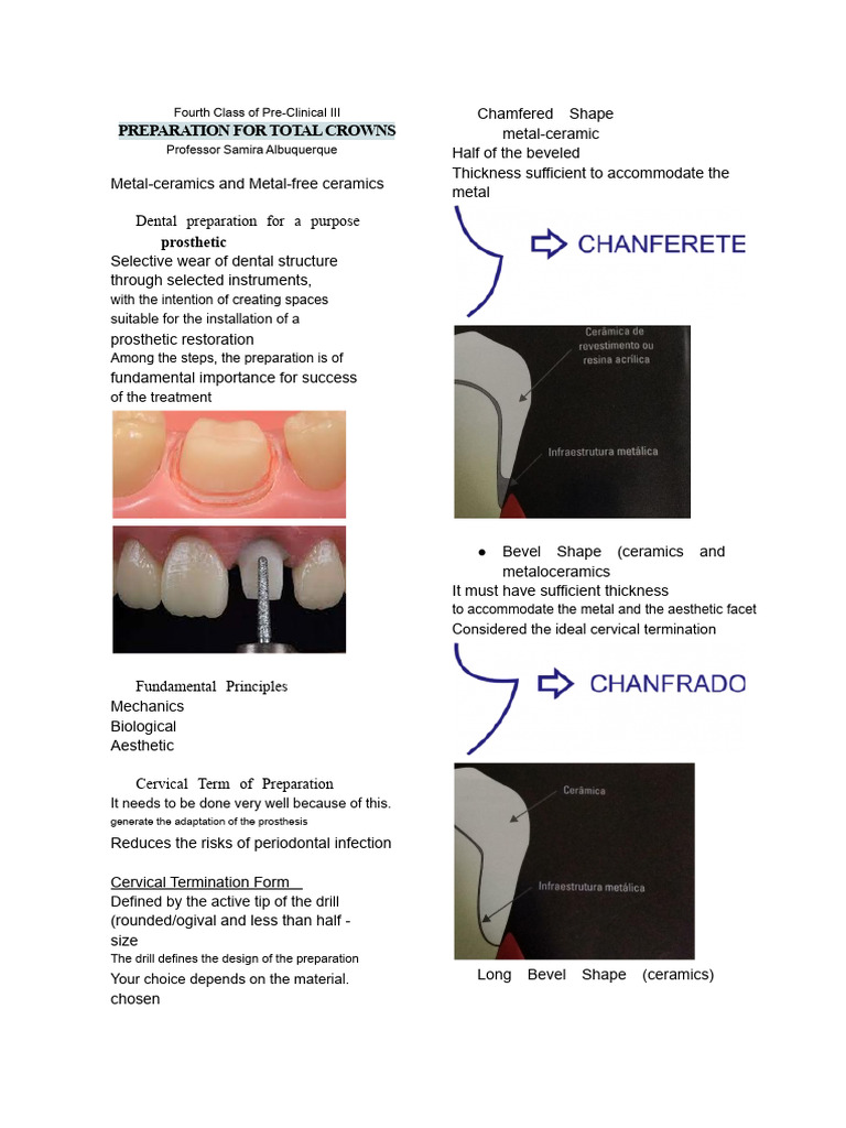 Preparation For Full Crowns Pdf Mouth Dentistry