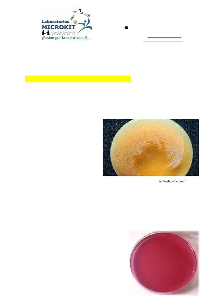 Dextrosa Triptona Agar Dta Bacillus | PDF | Bacilo | Microbiología
