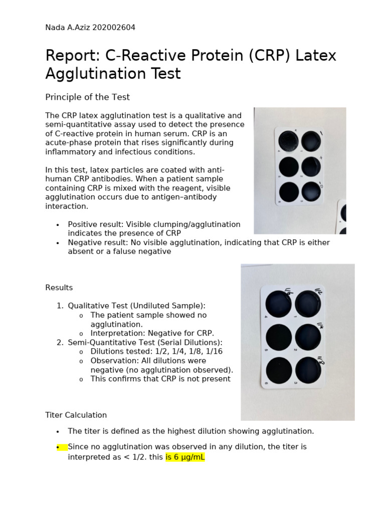 C-Reactive Protein Latex Test Results | PDF