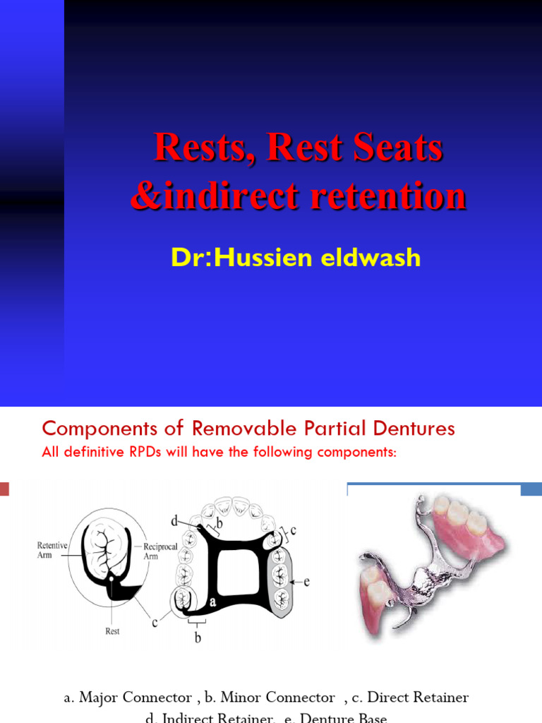 Rests & Rest Seats & Indirect Retention 1 | PDF | Tooth | Mouth