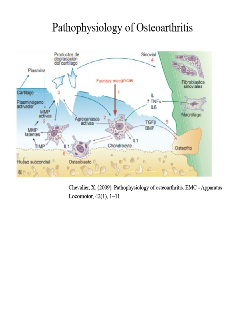 Pathophysiology of Osteoarthritis | PDF | Osteoarthritis | Cartilage
