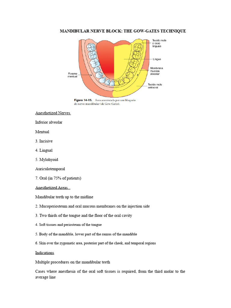 Gow-Gates Mandibular Nerve Block Guide | PDF | Human Anatomy