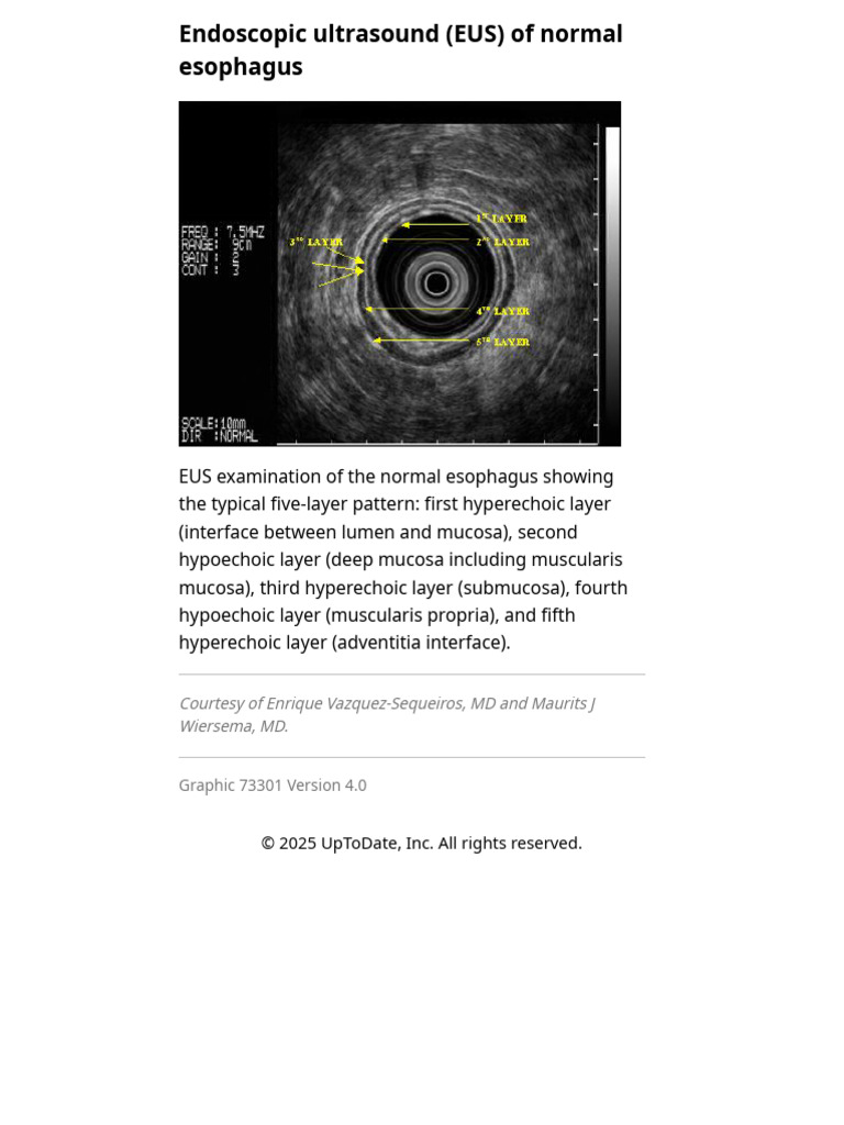 EUS Imaging of Normal Esophagus Layers | PDF