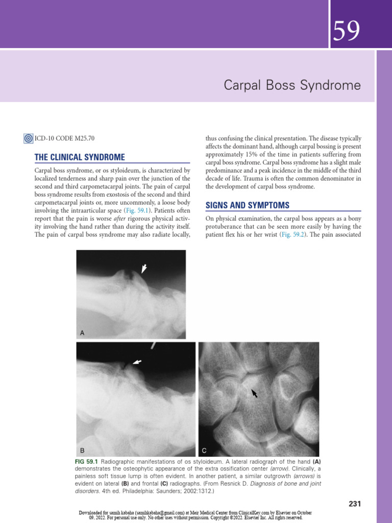 59 - Carpal Boss Syndrome | PDF | Hand | Medical Imaging