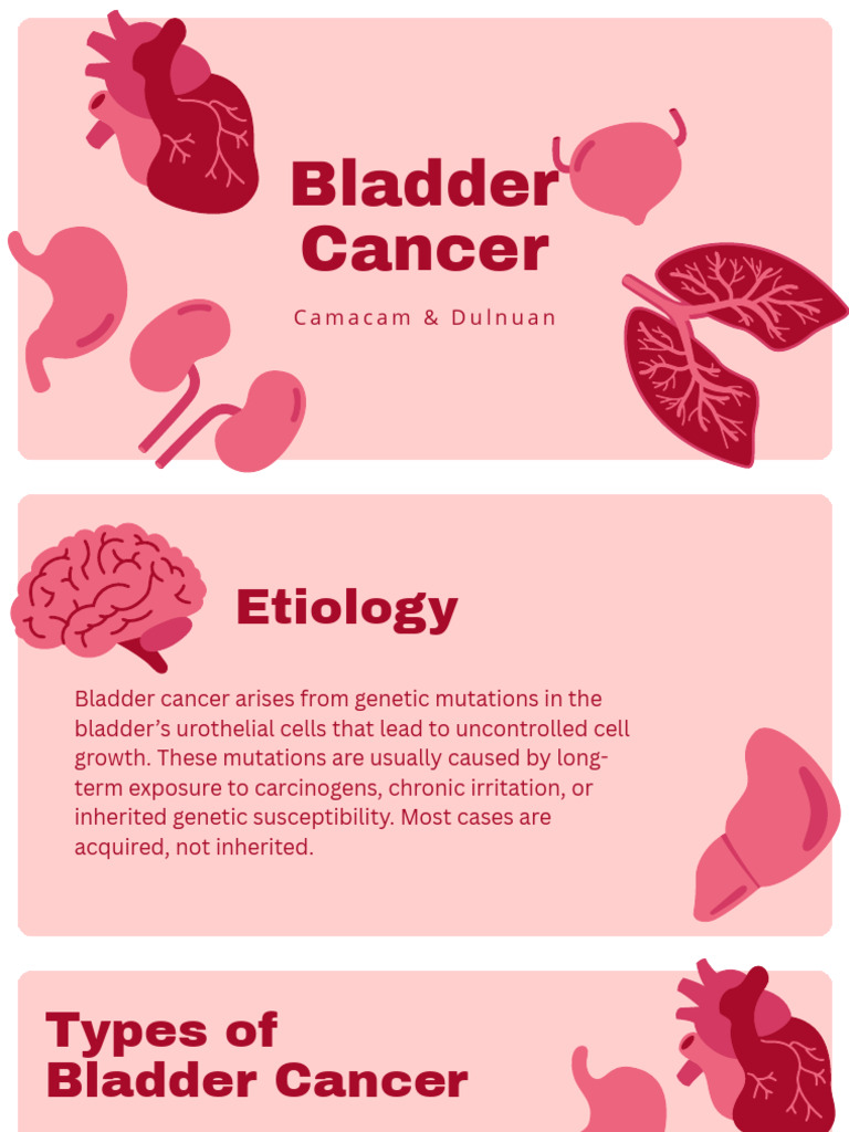 Bladder Cancer: Causes, Types, and Treatment | PDF | Cancer | Diseases ...