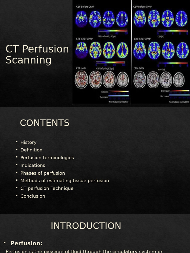 CT Perfusion Scanning | PDF | Ct Scan | Perfusion