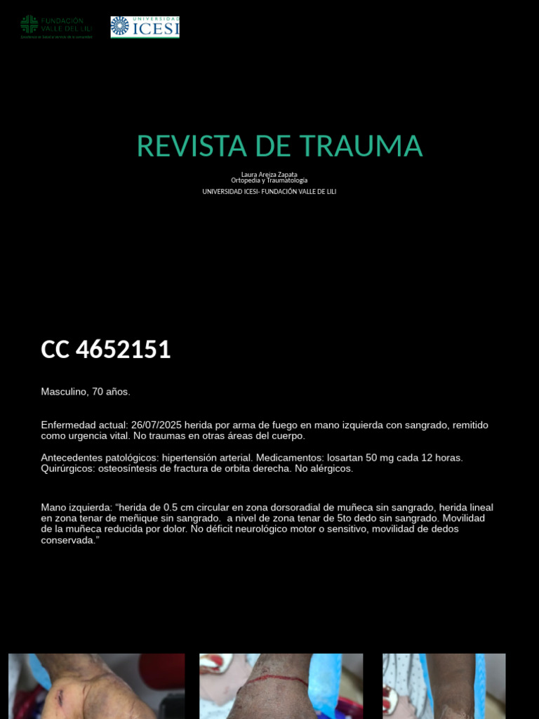 Manejo Quirúrgico de Fractura de Trapecio | PDF | Mano | Sistema ...