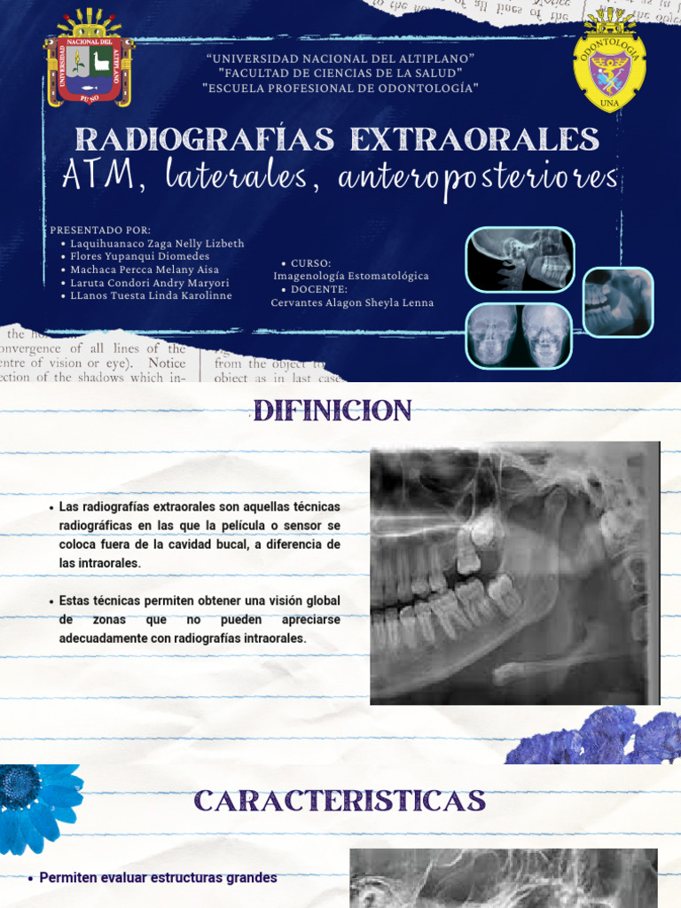 Radiografias Extraorales (ATM, Lateral, Anteroposterior) | PDF | Ct ...
