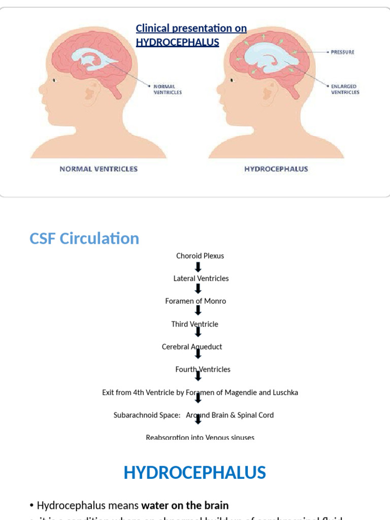 HYDROCEPHALUS-1 | PDF | Cerebrospinal Fluid | Neurology
