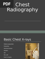Apical Lordotic Chest X-Ray Positioning | PDF | Thorax (Human Anatomy ...
