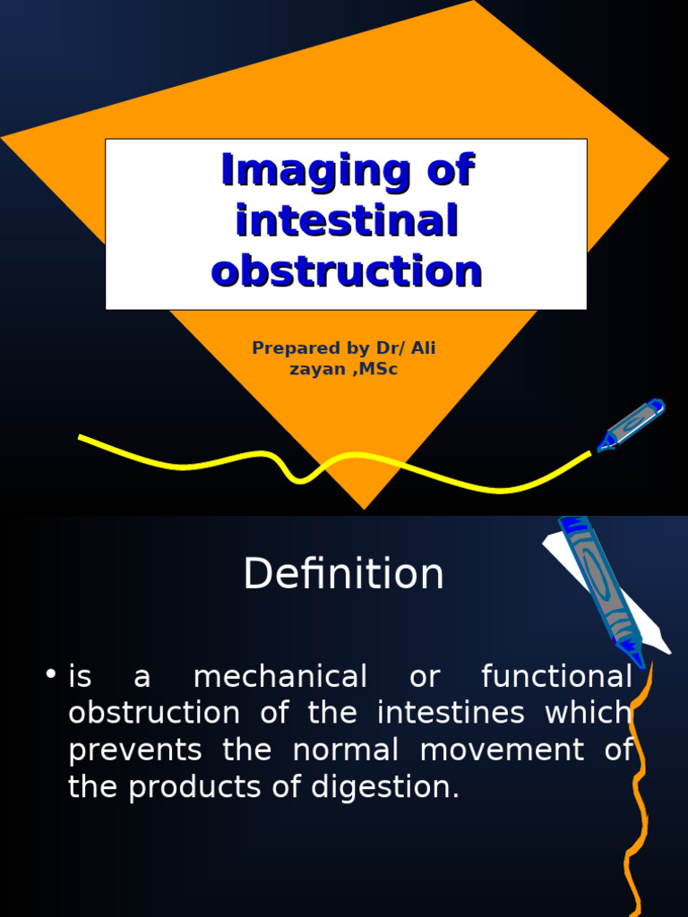 Imaging Techniques for Intestinal Obstruction | PDF | Digestive ...