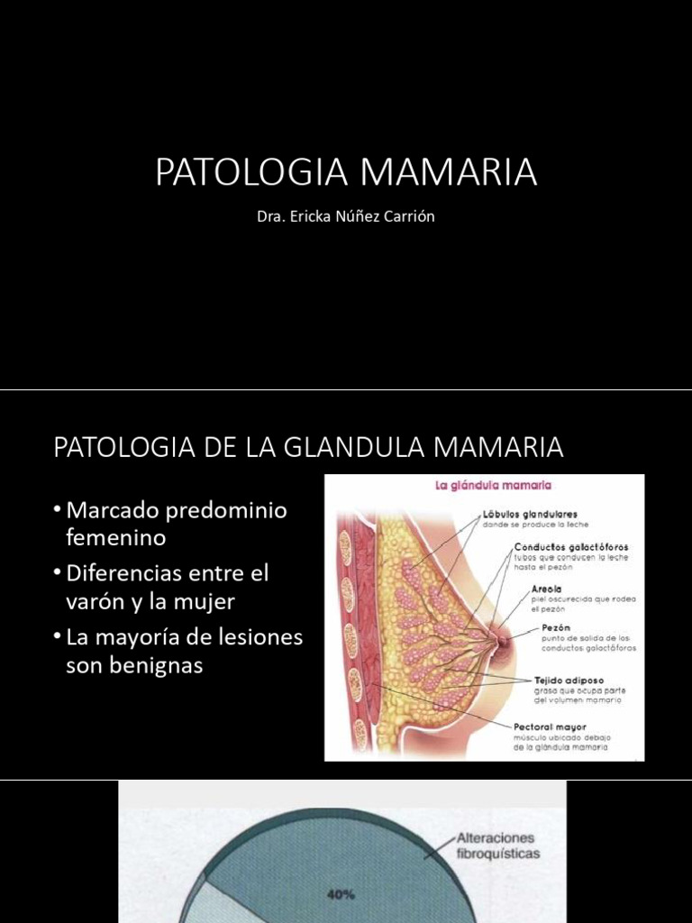 Patologia Mamaria 2024-Ii | PDF | Cáncer de mama | Pecho