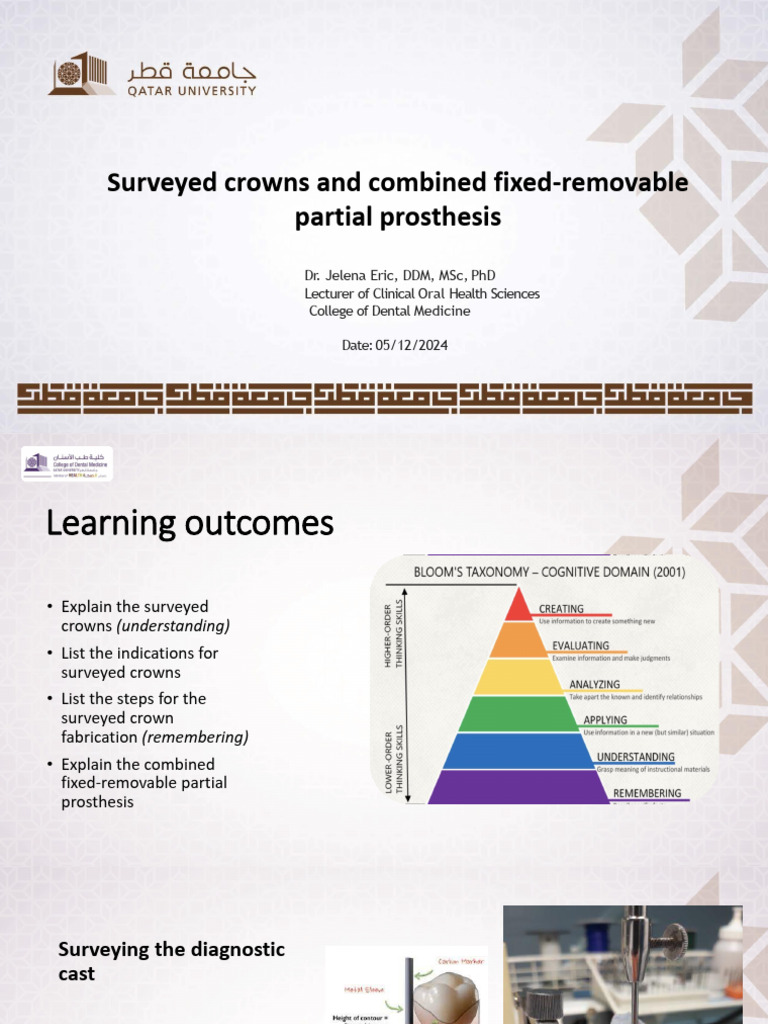 Surveyed Crowns and Combined F R Partial Prosthesis | PDF | Dentures ...