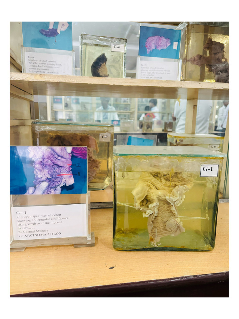 Pathology Specimen | PDF
