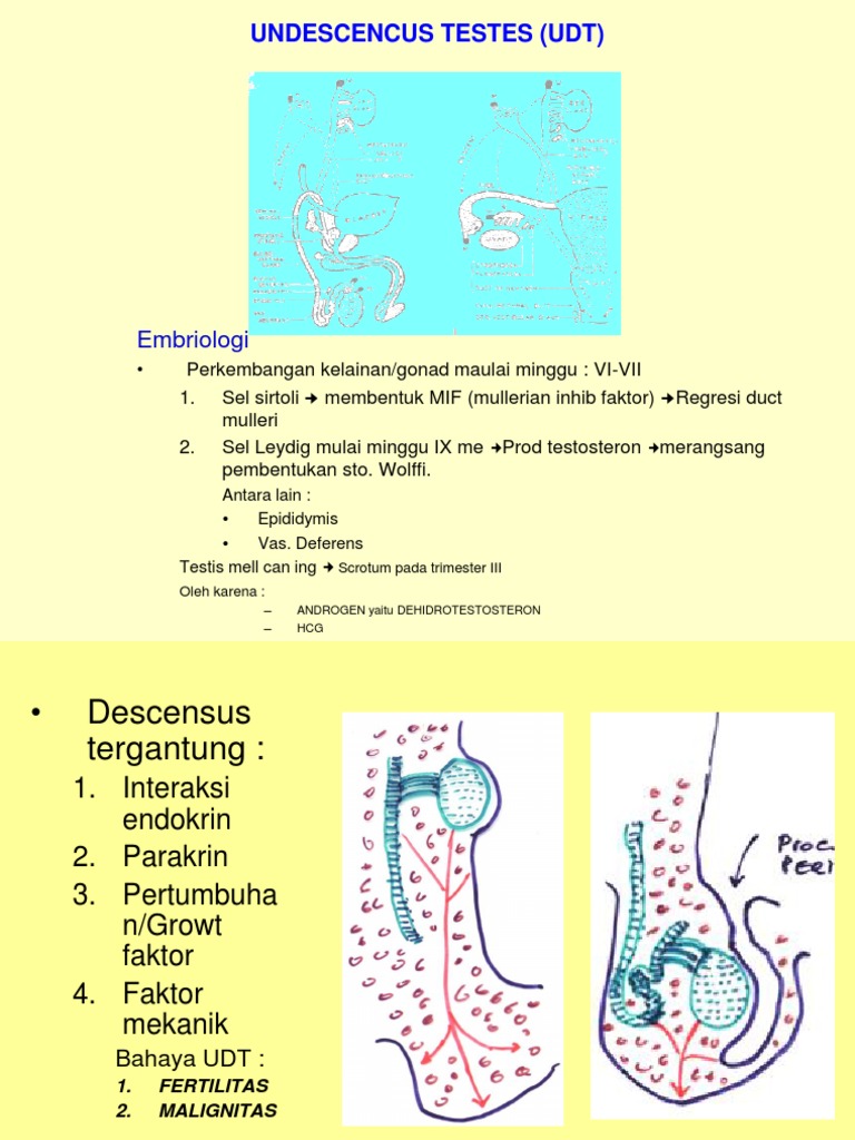 Undesensus Testis | PDF