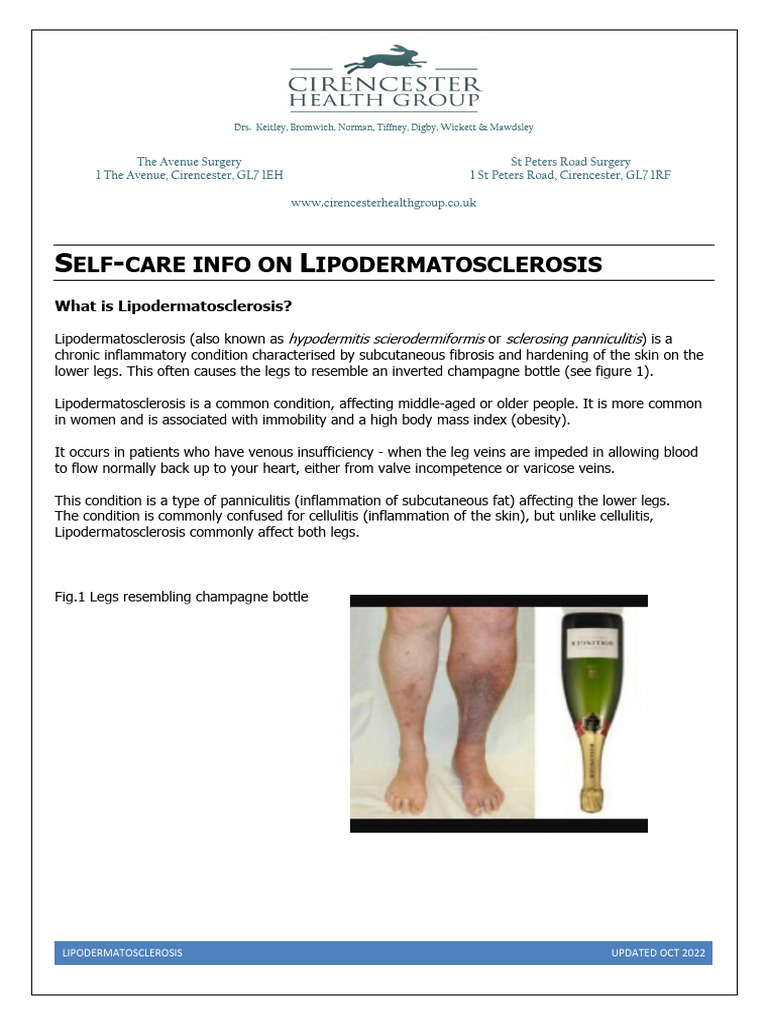Lipodermatosclerosis CHG | PDF | Vein | Varicose Veins