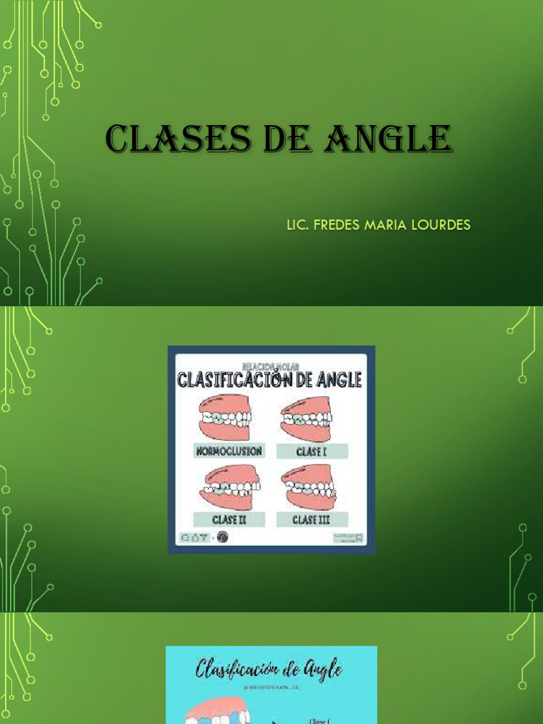 Clases de Angle | PDF | Odontología | Ramas de Odontología