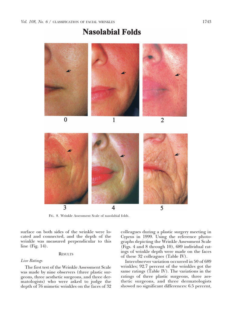 WrinkleScaleLemperle 9 16 | PDF | Wrinkle | Skin