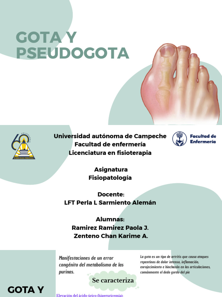 Gota y Artritis Gotosas: Causas y Tratamiento | PDF | Gota ...