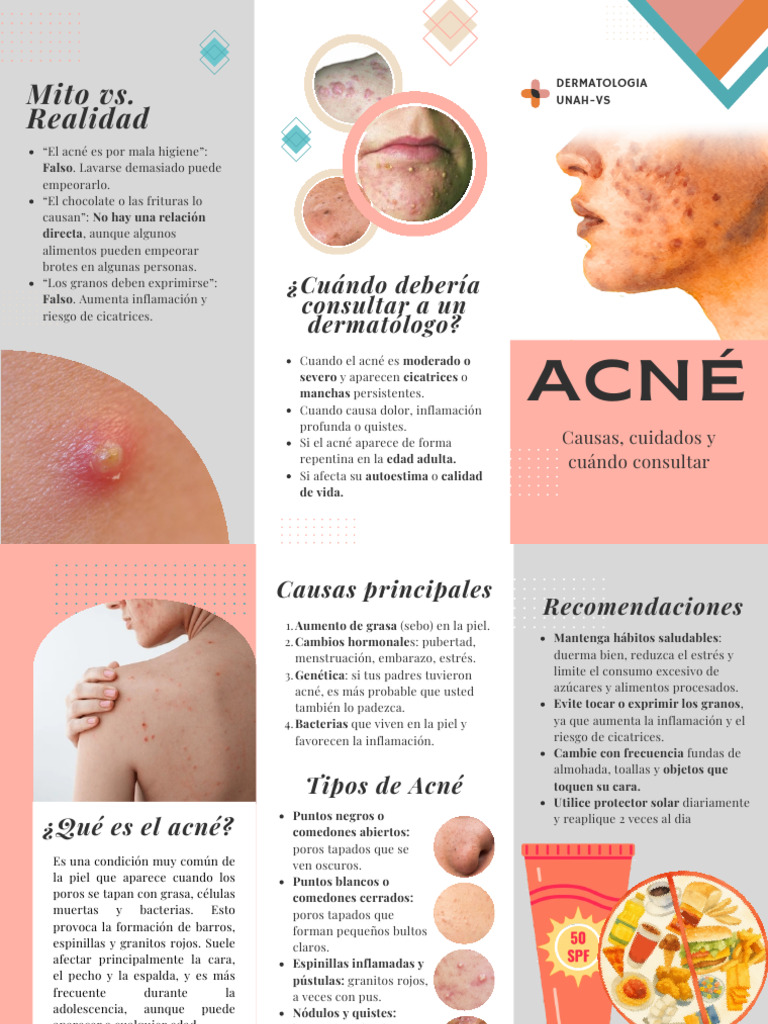 Causas y cuidados del acné | PDF | Dermatología | Enfermedades y trastornos