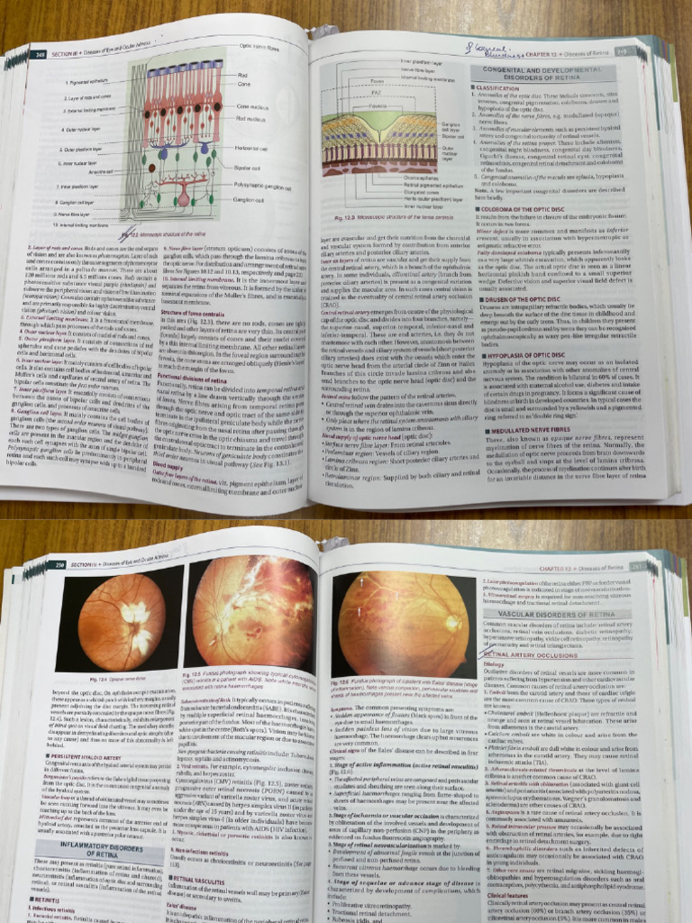 Optha AK - Retina | PDF
