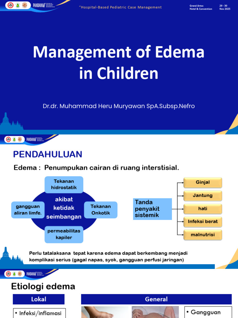 Management of Edema in Children 291125 | PDF