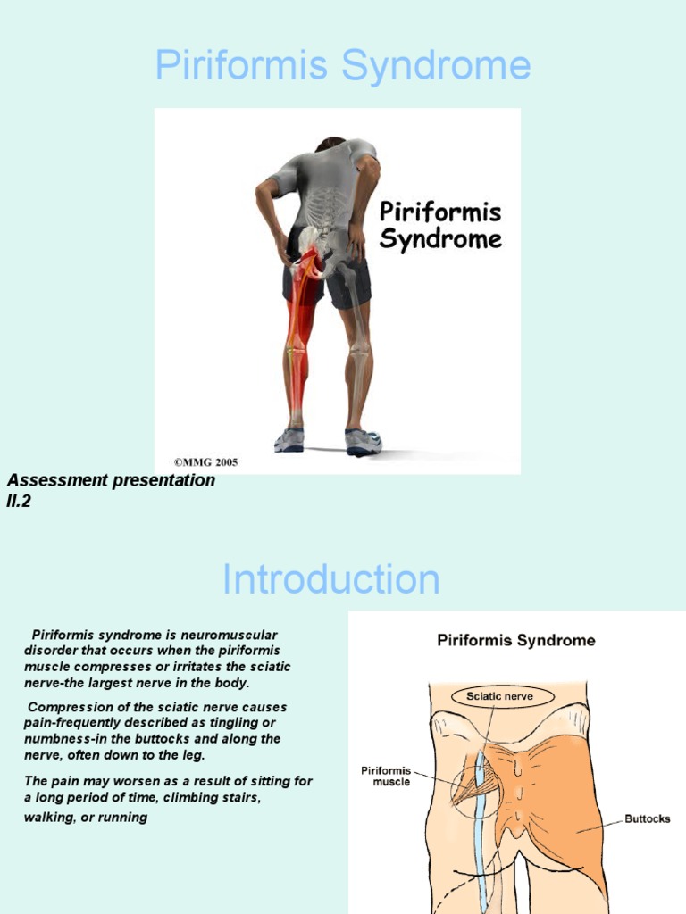 Piriformis Syndrome Assessment www.fysioaviv.nl | Musculoskeletal ...