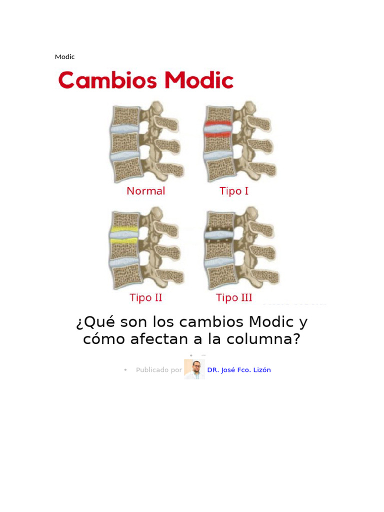Modic | PDF | Dolor lumbar | Dolor