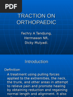 Buck's Extension Traction Overview | PDF