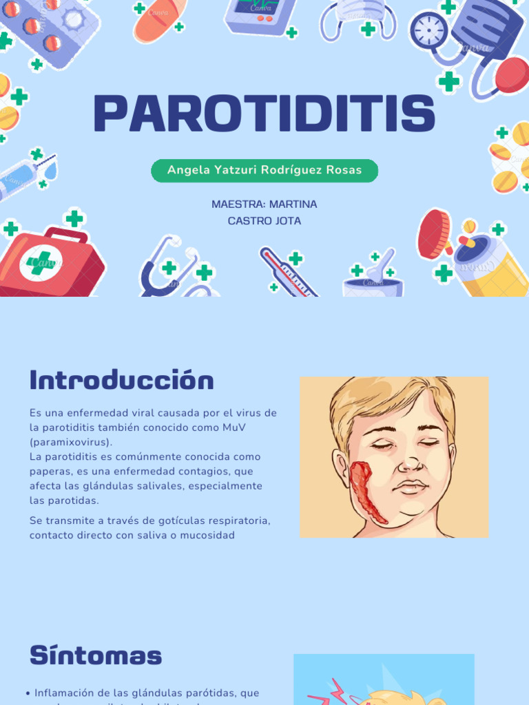 Parotiditis: Síntomas, Diagnóstico y Prevención | PDF | Inmunología ...