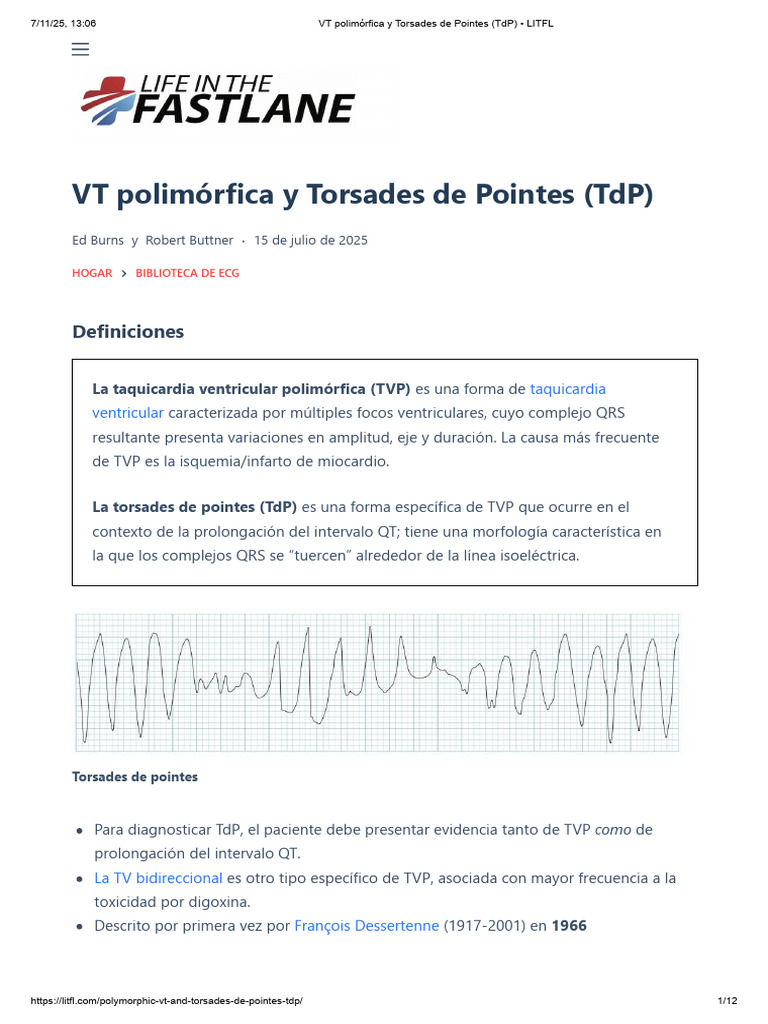 VT polimórfica y Torsades de Pointes (TdP) • LITFL | PDF | Fisiología ...