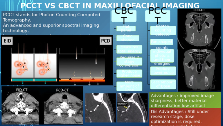 PCCT Vs CBCT | PDF